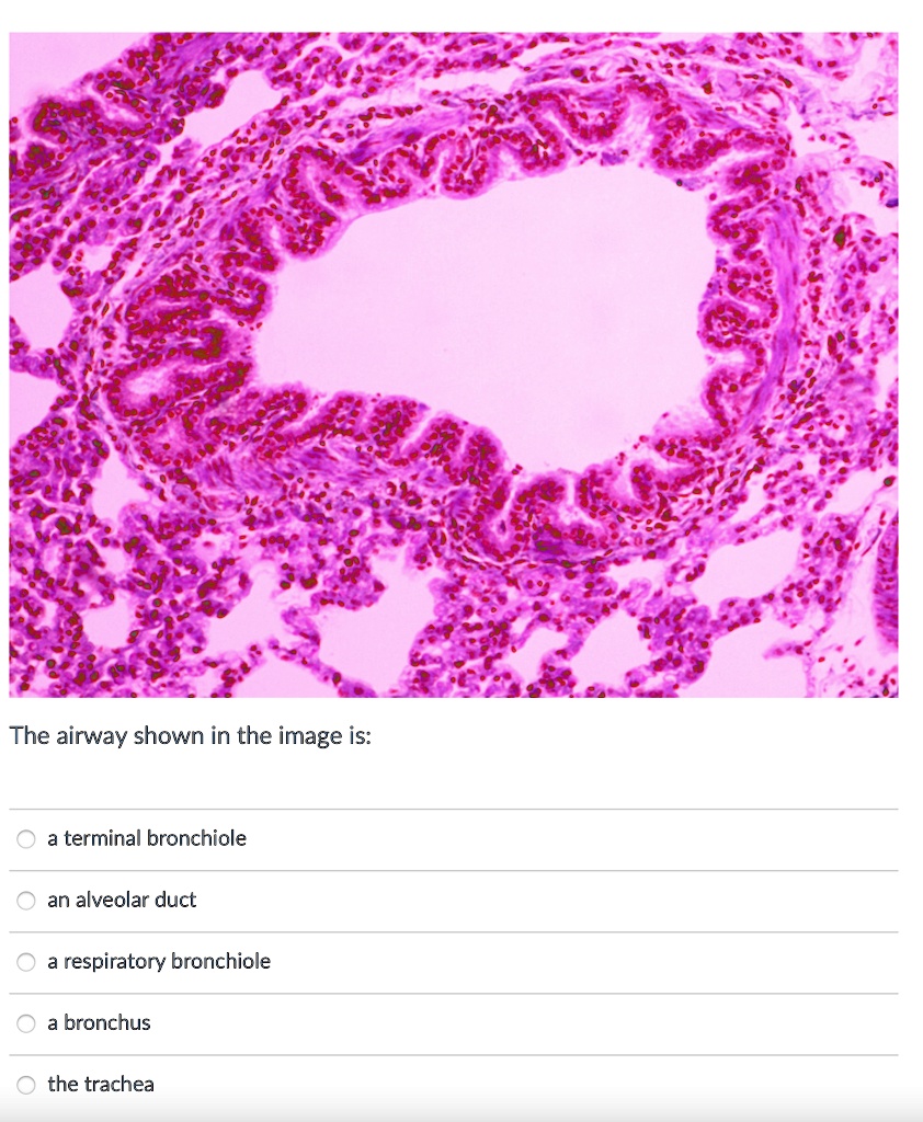 The airway shown in the image is: a terminal bronchiole an alveolar ...
