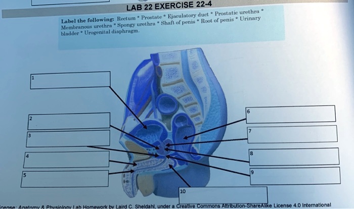 LAB 22 EXERCISE 22-4 Label the following: Rectum * Prostate ...