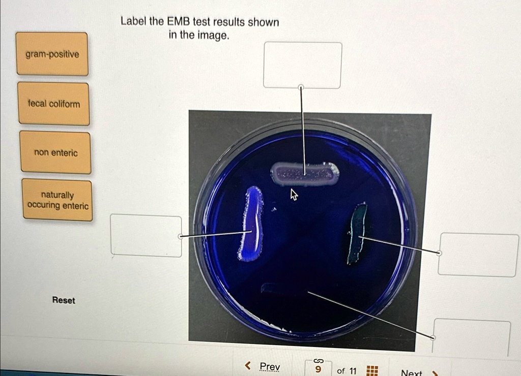 SOLVED: Label the EMB test results shown in the image. Reset Prev infty ...