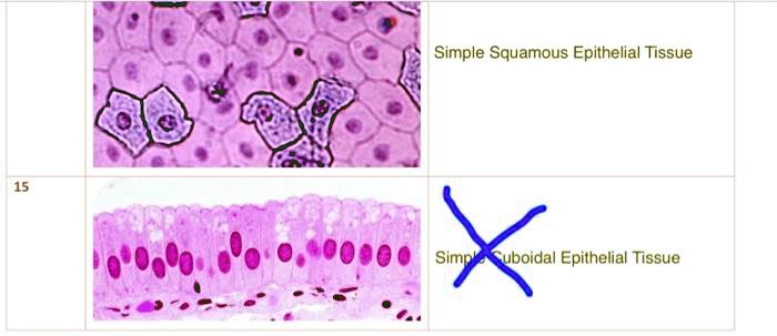 SOLVED: Simple Squamous Epithelial Tissue Simi Cuboidal Epithelial Tissue