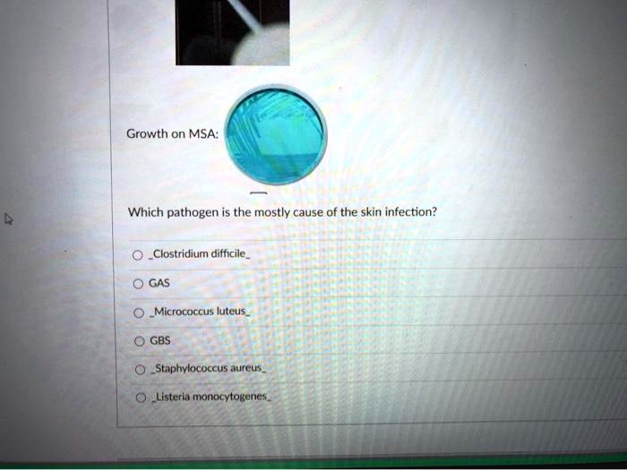 SOLVED: Growth on MSA: Which pathogen is the mostly cause of the skin ...