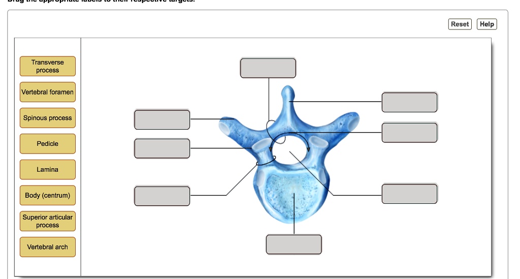SOLVED: Transverse process Vertebral foramen Spinous process Pedicle ...