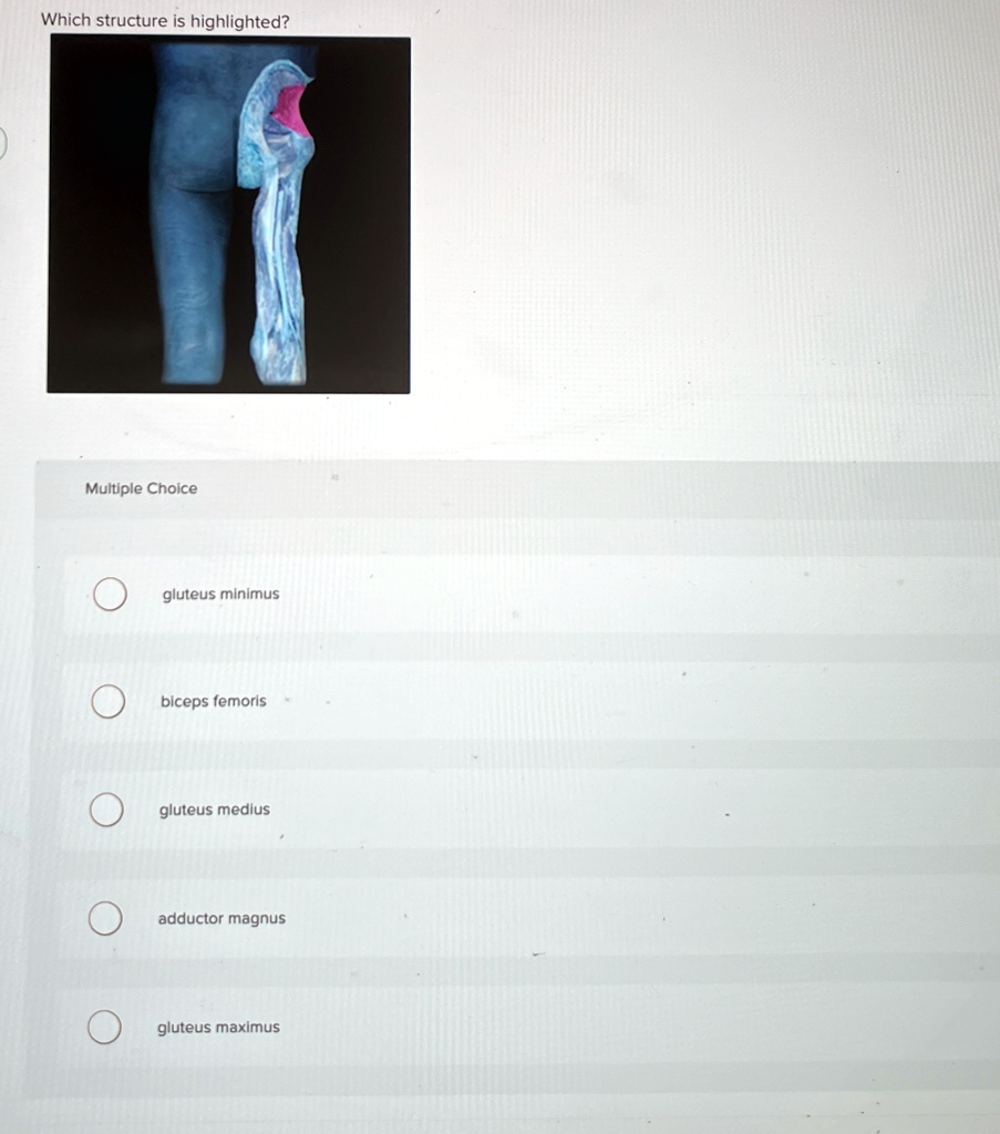 which structure is highlighted multiple choice gluteus minimus biceps ...