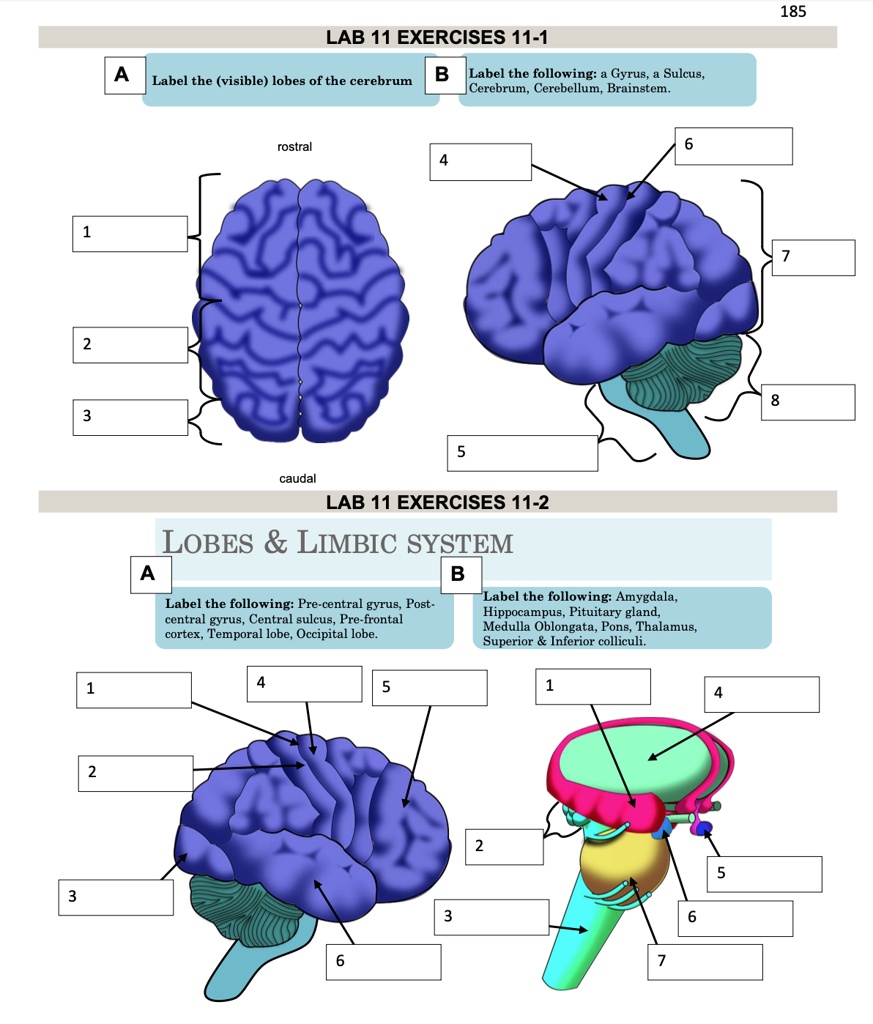 [GET ANSWER] 185 lab 11 exercises11 1 label the visible lobes of the ...