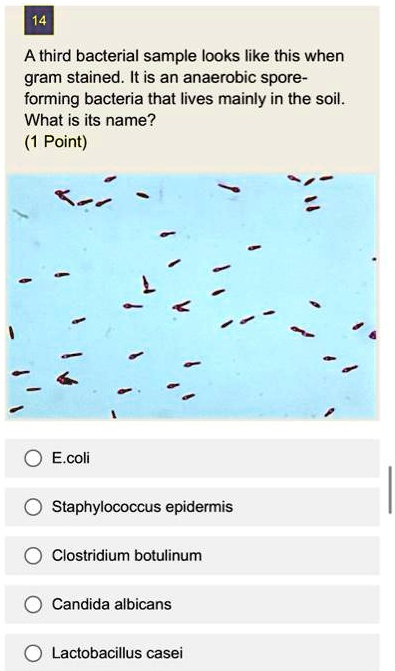 SOLVED: A third bacterial sample looks like this when gram stained. It ...