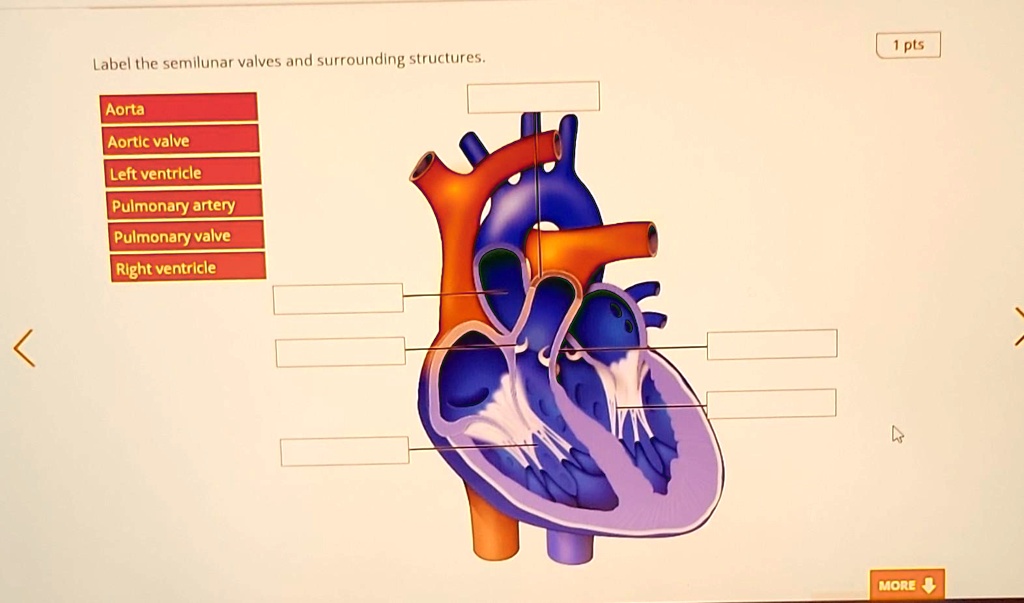 SOLVED: Label the semilunar valves and surrounding structures: - Aorta ...