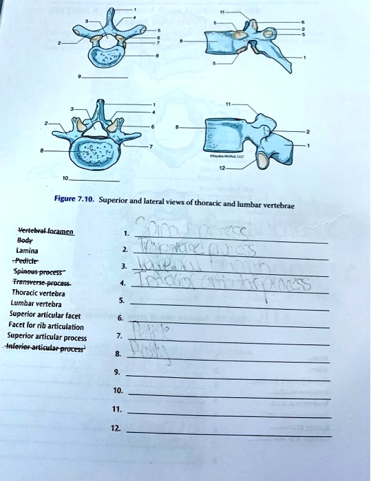 SOLVED: I need help labeling the following parts: Figure 7.10. Superior ...