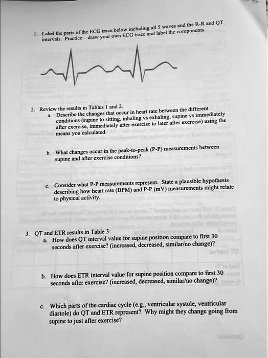 1. Label the parts of the ECG trace below including all 5 waves and the ...