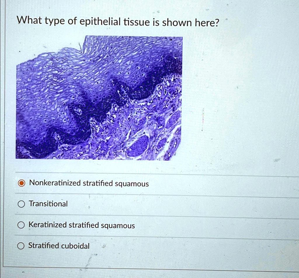 what type of epithelial tissue is shown here nonkeratinized stratified ...