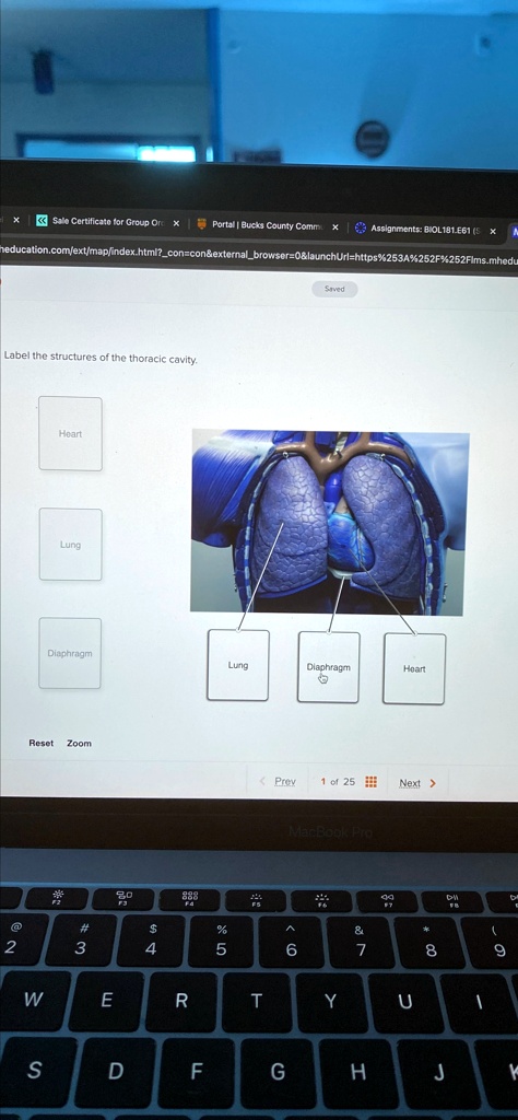 SOLVED: Label the structures of the Abdominopelvic cavity: Reset ...