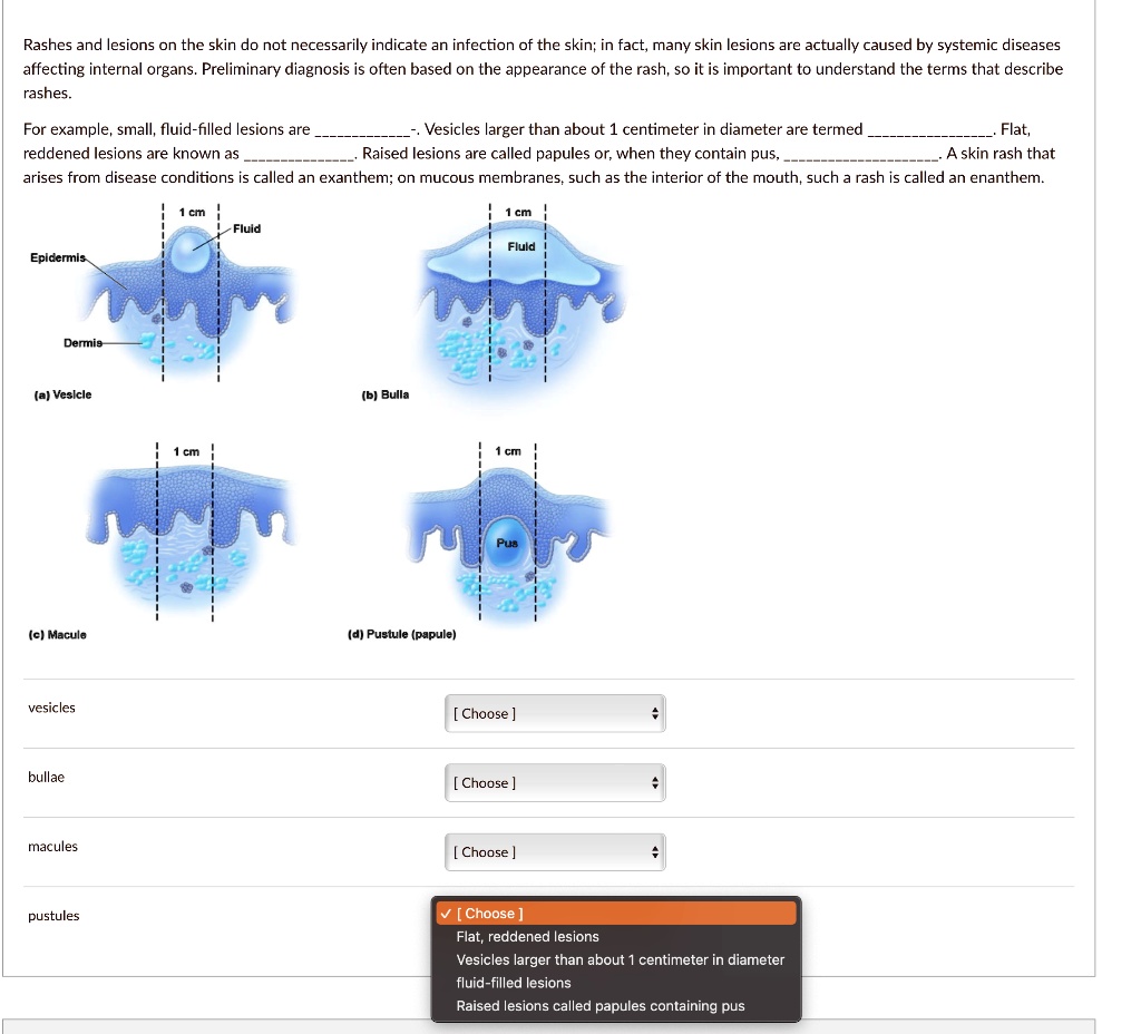 Rashes and lesions on the skin do not necessarily indicate an infection ...