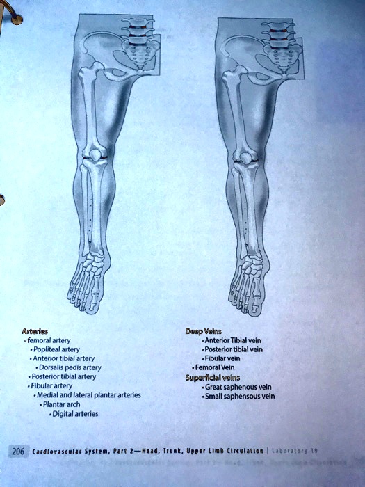 SOLVED: draw the following blood vessels on the corresponding image ...