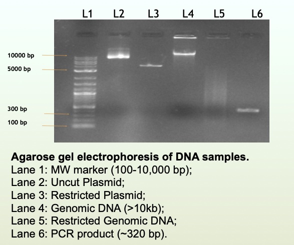 SOLVED: L2 L3 L4 57 L6 10000 bp 5000 bp 300 bp 100 bp Agarose gel electrophoresis of DNA samples ...