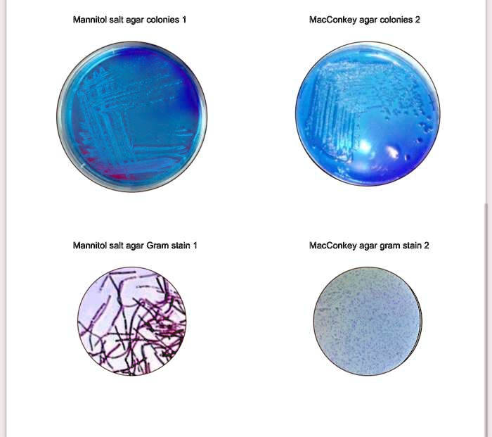 Genius and species for unknown (-) and (+) Mannitol salt agar colonies ...