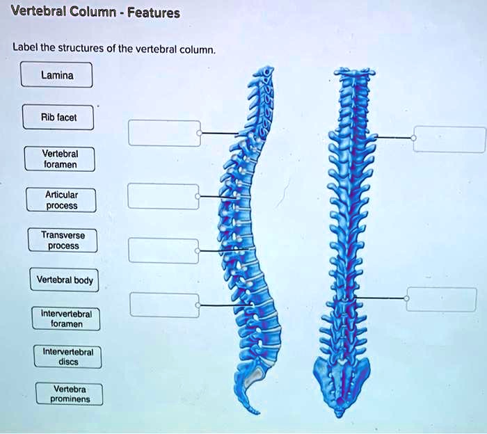 SOLVED: Label the structures of the vertebral column: - Lamina - Rib ...