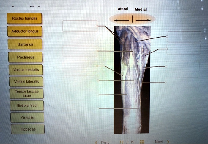name the superficial anterior thigh muscles of a cadaver including the ...