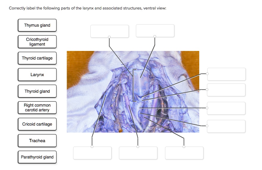 Correctly label the following parts of the larynx and associated ...