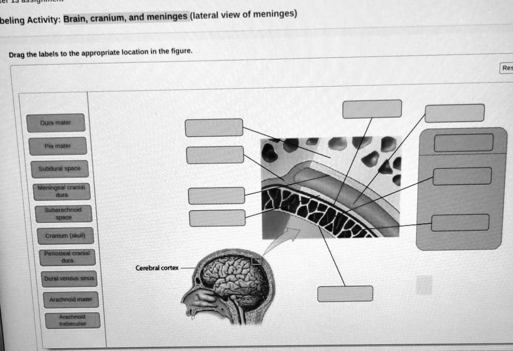 SOLVED: Text: Brain, Cranium, and Meninges. Please label. Labeling Activity: Brain, cranium, and ...