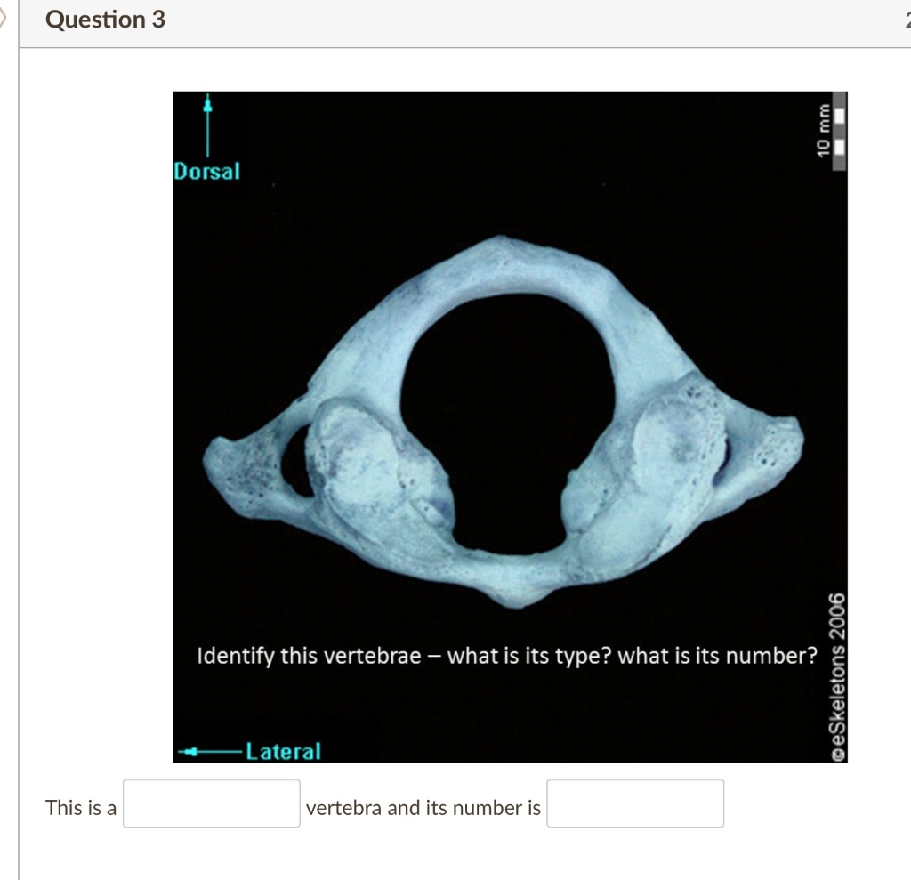 question 3 1 2 dorsal 8 identify this vertebrae what is its type what ...