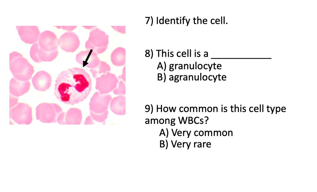 SOLVED:7) Identify the cell: 8) This cell is a A) granulocyte B ...