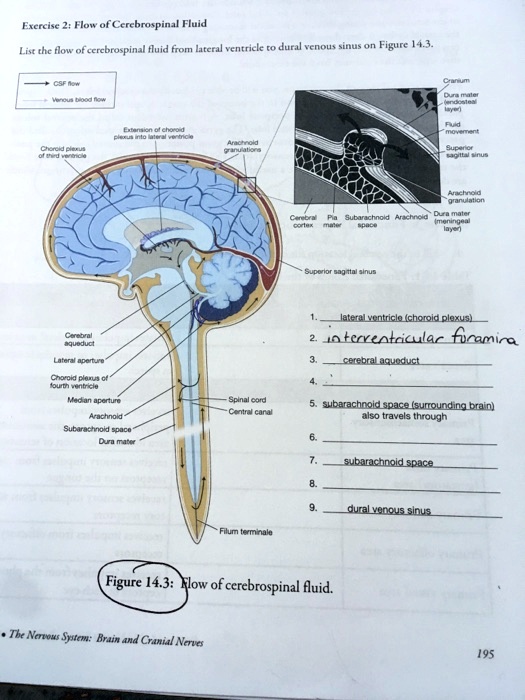 Exercise 2: Flow of Cerebrospinal Fluid List the flow of cerebrospinal fluid from lateral ...
