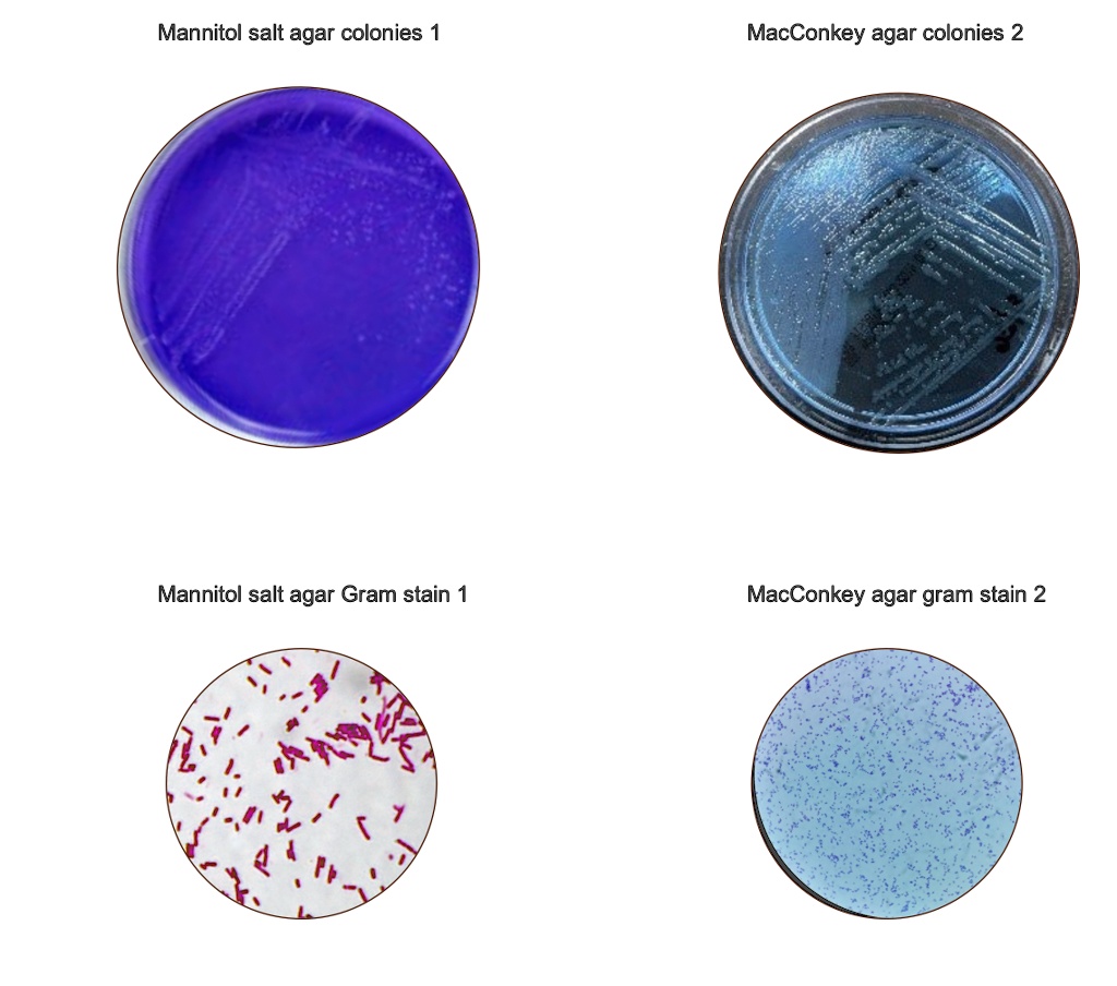 mannitol salt agar colonies 1 macconkey agar colonies 2 mannitol salt ...