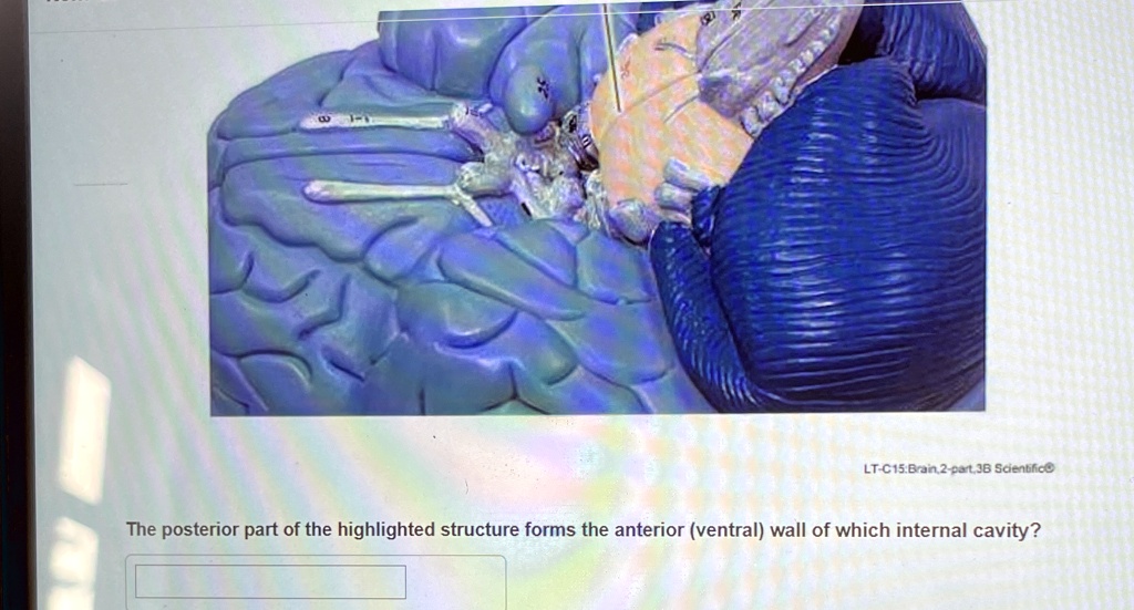 LT-C15:Brain, 2-part, 3B Scientific? The posterior part of the highlighted structure forms the ...