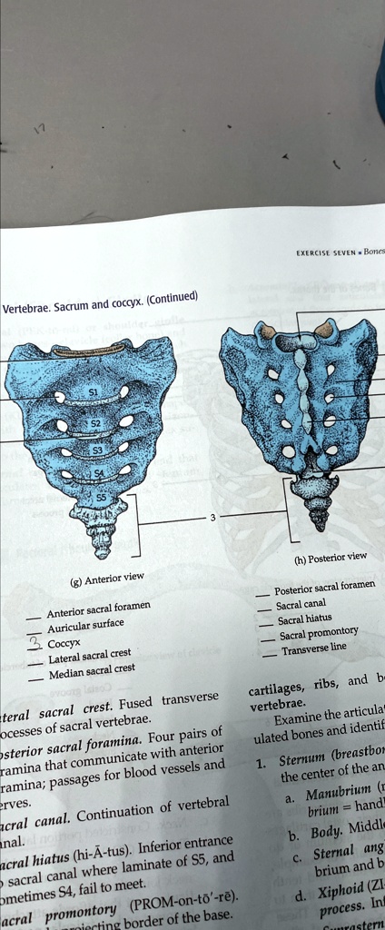exercise seven bone vertebrae sacrum and coccyx continued g anterior ...