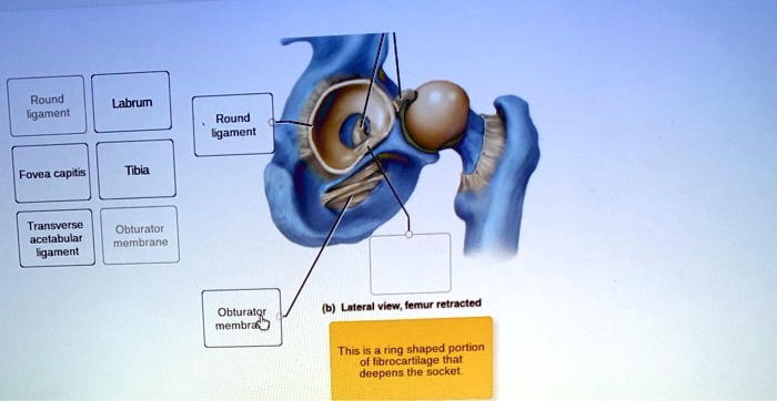 Round ligament Labrum Round ligament Fovea capitis Tibia Transverse ...