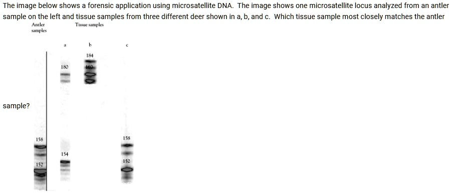 The image below shows a forensic application using microsatellite DNA ...