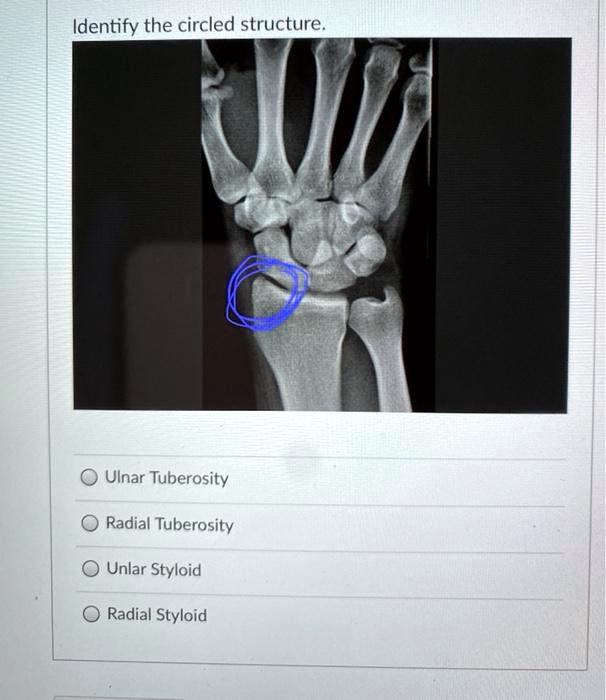 identify the circled structure o ulnar tuberosity o radial tuberosity o ...