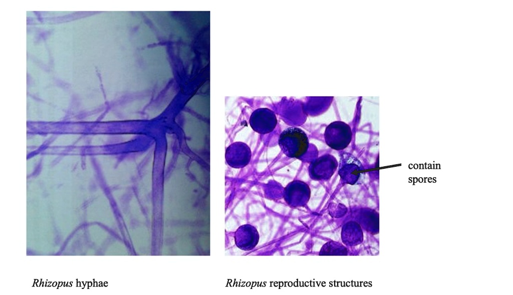 Types Of Hyphae In Rhizopus