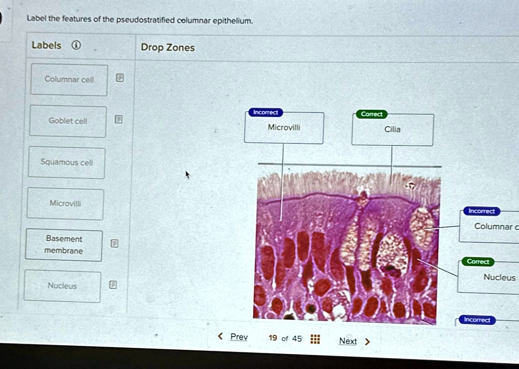 Label the features of the pseudostratified columnar epithelium. Labels ...