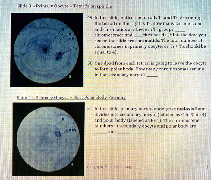 slide 3 primary qocyte tetradson spindle 49 in this slide notice the ...