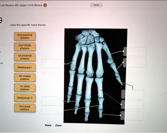 Lab Review #6: Upper Limb Bones Label the specific hand bones. 2nd ...