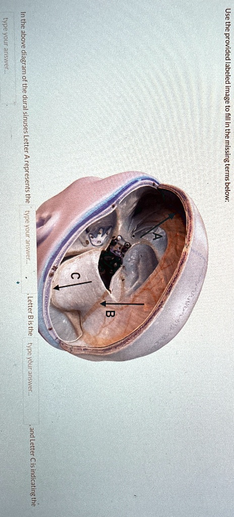 [GET ANSWER] use the provided labeled image to fill in the missing ...