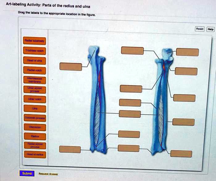 Art-labeling Activity: Parts of the radius and ulna Drag the labels to ...