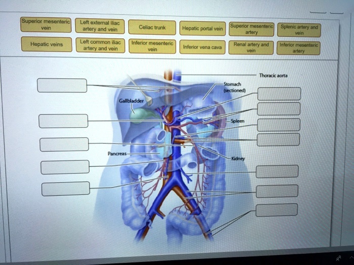 Superior mesenteric vein Left external iliac artery and vein Celiac ...