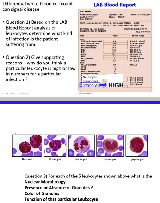 differential white blood cell count can signal disease lab blood report ...