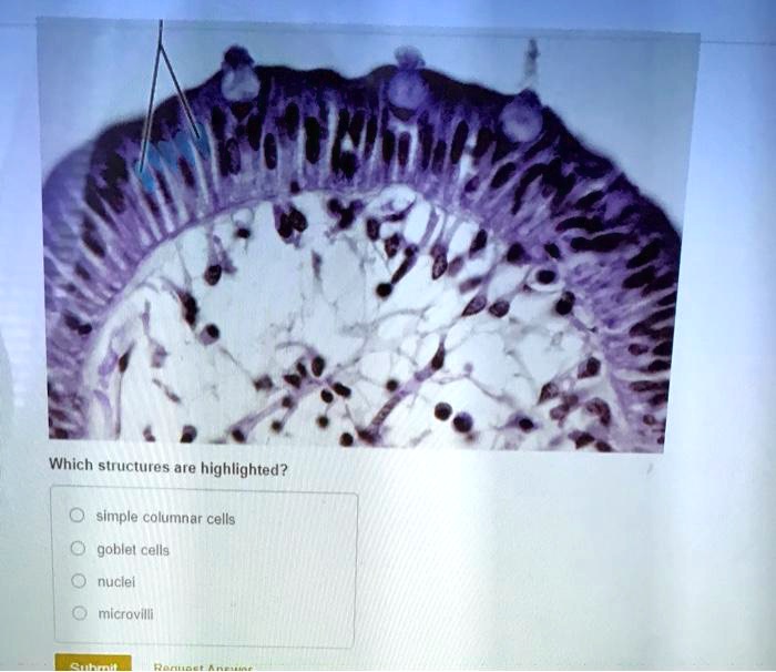 SOLVED: Which structures are highlighted? simple columnar cells O goblet cells nuclei microvilli aut