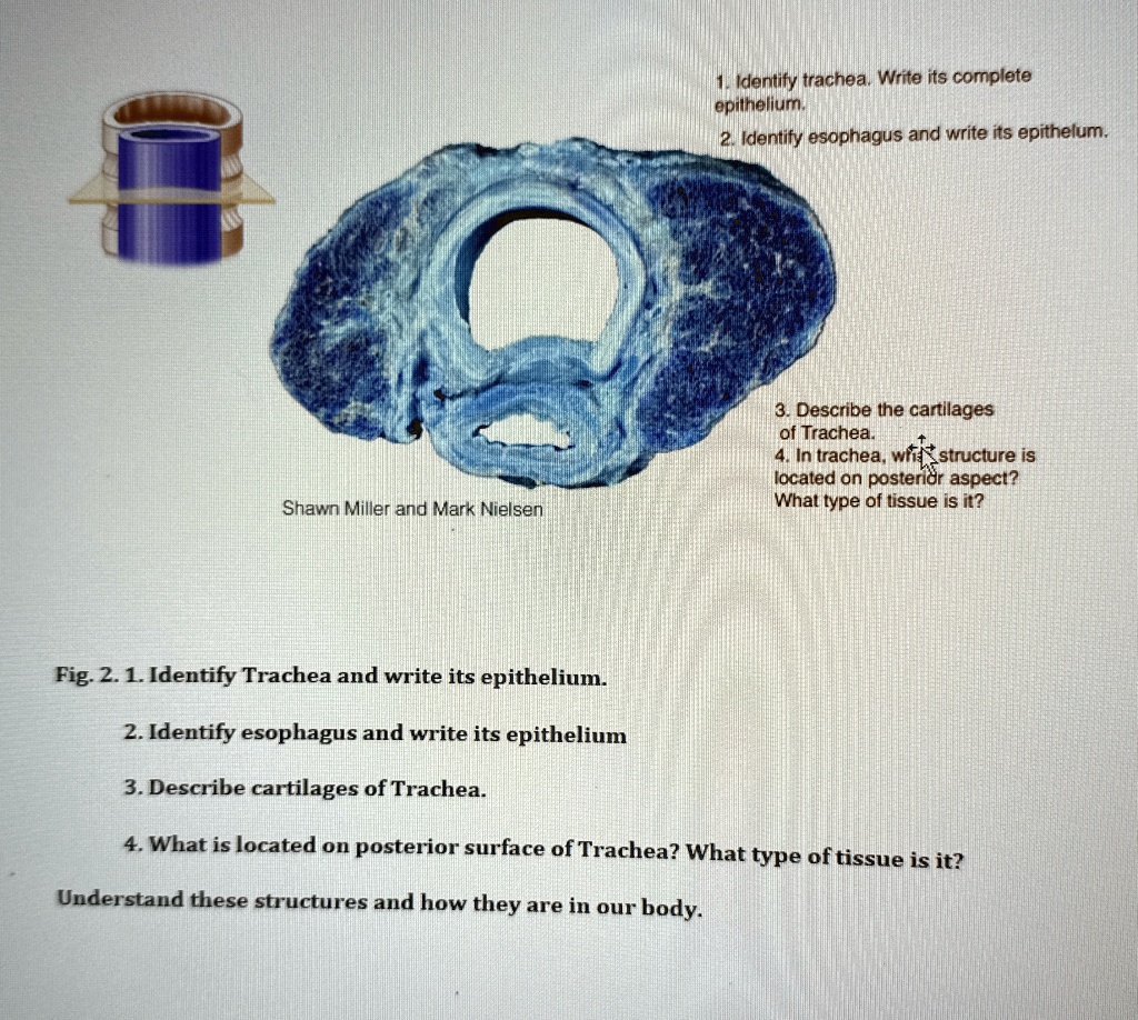 1. Identify trachea. Write its complete epithelium. 2. Identify ...