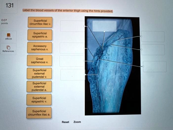 Label the blood vessels of the anterior thigh using the hints provided ...