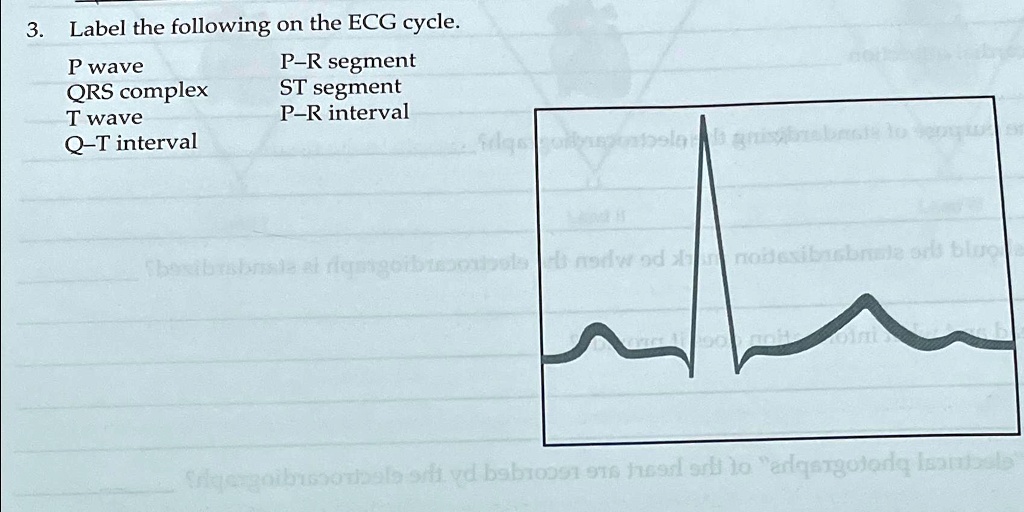 SOLVED: Label the following on the ECG cycle: P wave P-R segment QRS complex ST segment T wave P ...
