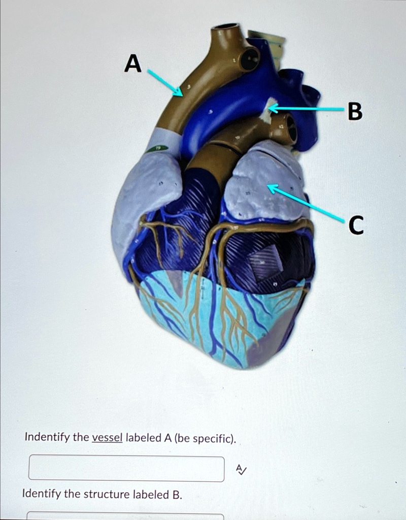 A Indentify the vessel labeled A (be specific). A Identify the structure labeled B. B C