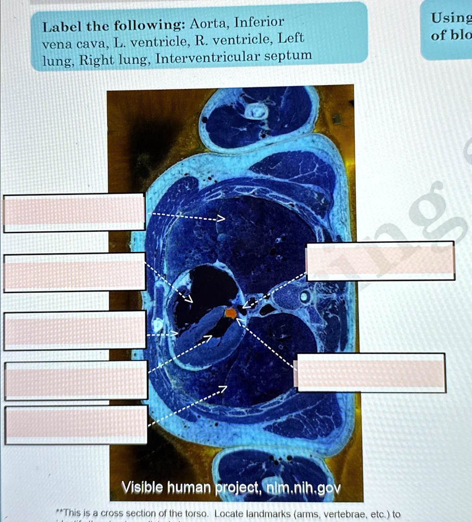 SOLVED: Label the following: Aorta, Inferior vena cava, Left ventricle ...