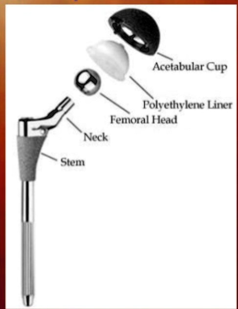How To Design A Prosthetic Hip Replacements Using Inventor 2018