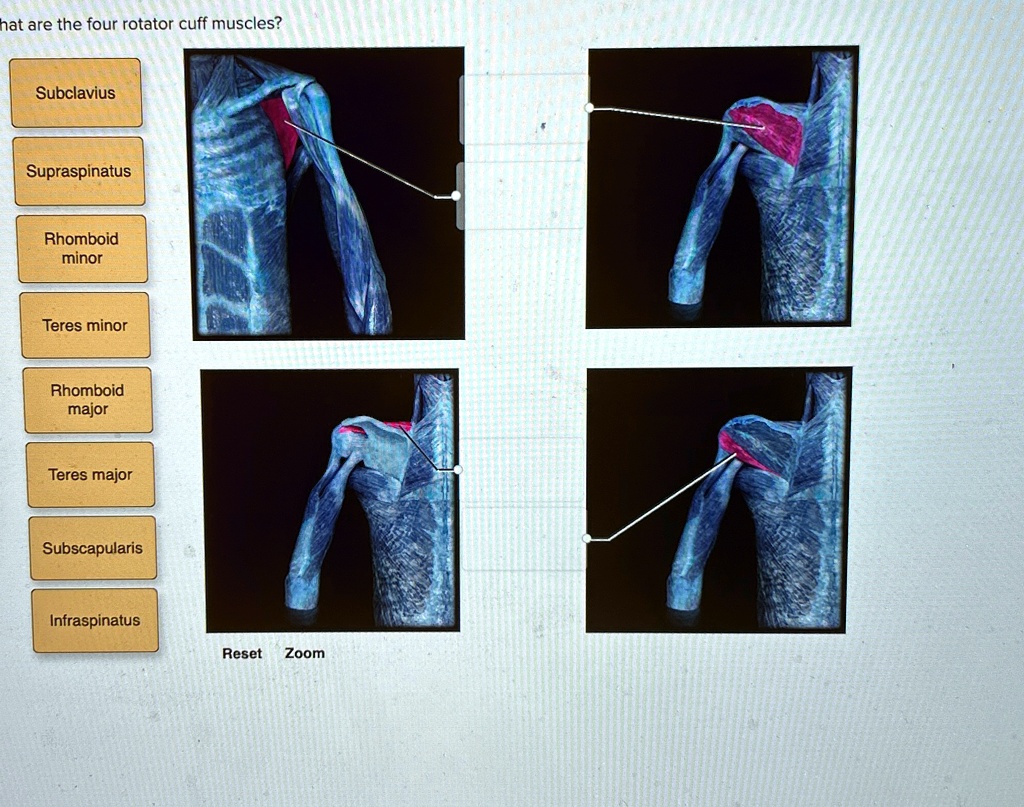 The four rotator cuff muscles are Supraspinatus, Infraspinatus, Teres ...