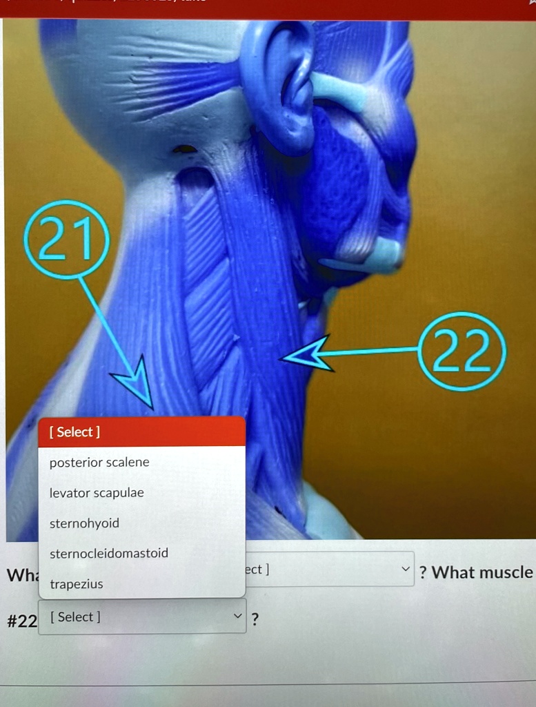 (21) 22 [Select] posterior scalene levator scapulae sternohyoid ...