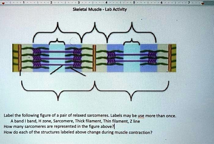 Skeletal Muscle - Lab Activity Label the following figure of a pair of ...