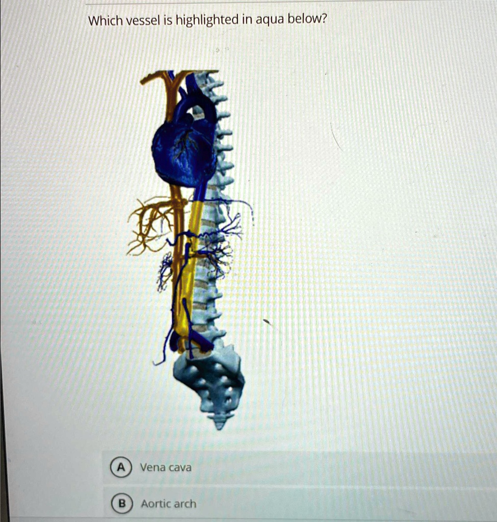 VIDEO solution: Which vessel is highlighted in aqua below? Vena cava ...